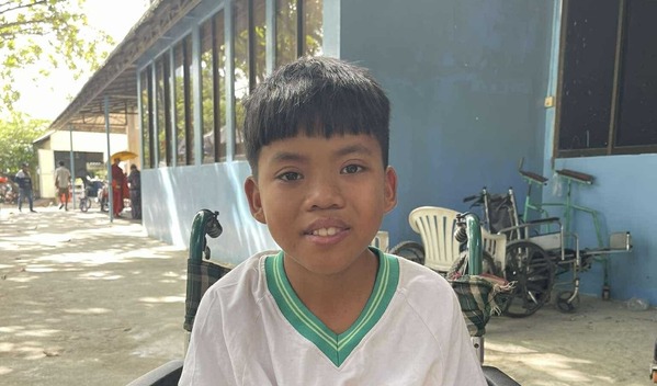 Success Youk From Cambodia Raised 382 To Fund Contracture Release Surgery Watsi