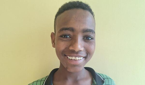 Shalo from Ethiopia raised $1,293 to fund surgery for a birth condition ...