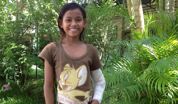 Srey Roth from Cambodia raised $300 to repair her fractured elbow. | Watsi