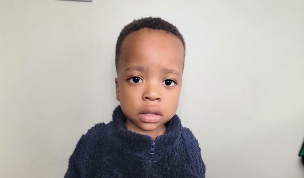 Success! Sahir from Tanzania raised $341 to fund clubfoot treatment and ...