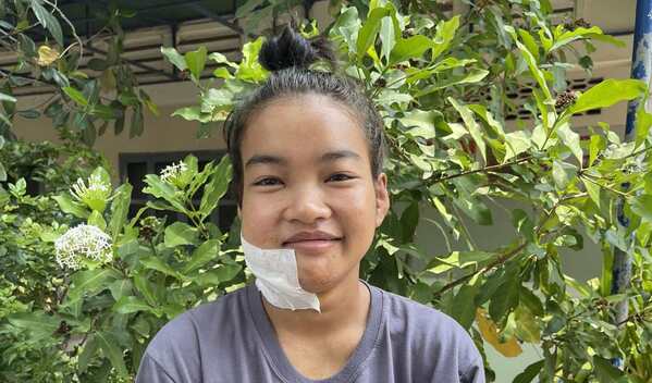Success! Leanghorng from Cambodia raised $292 to fund jawbone surgery. | Watsi