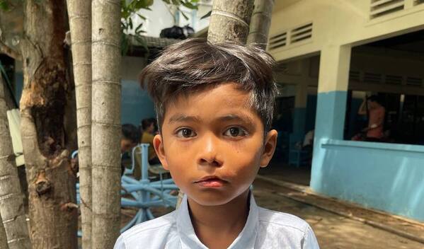 Success! Safik from Cambodia raised $665 to fund an alveolar bone graft ...
