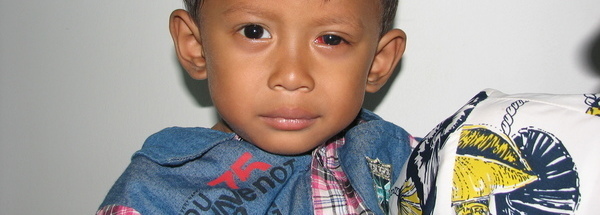 Reaksa from Cambodia raised $150 to remove a traumatic cataract in his ...