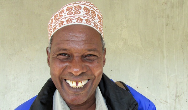 Mahamud from Kenya raised $1,410 so he can use his hand again. | Watsi